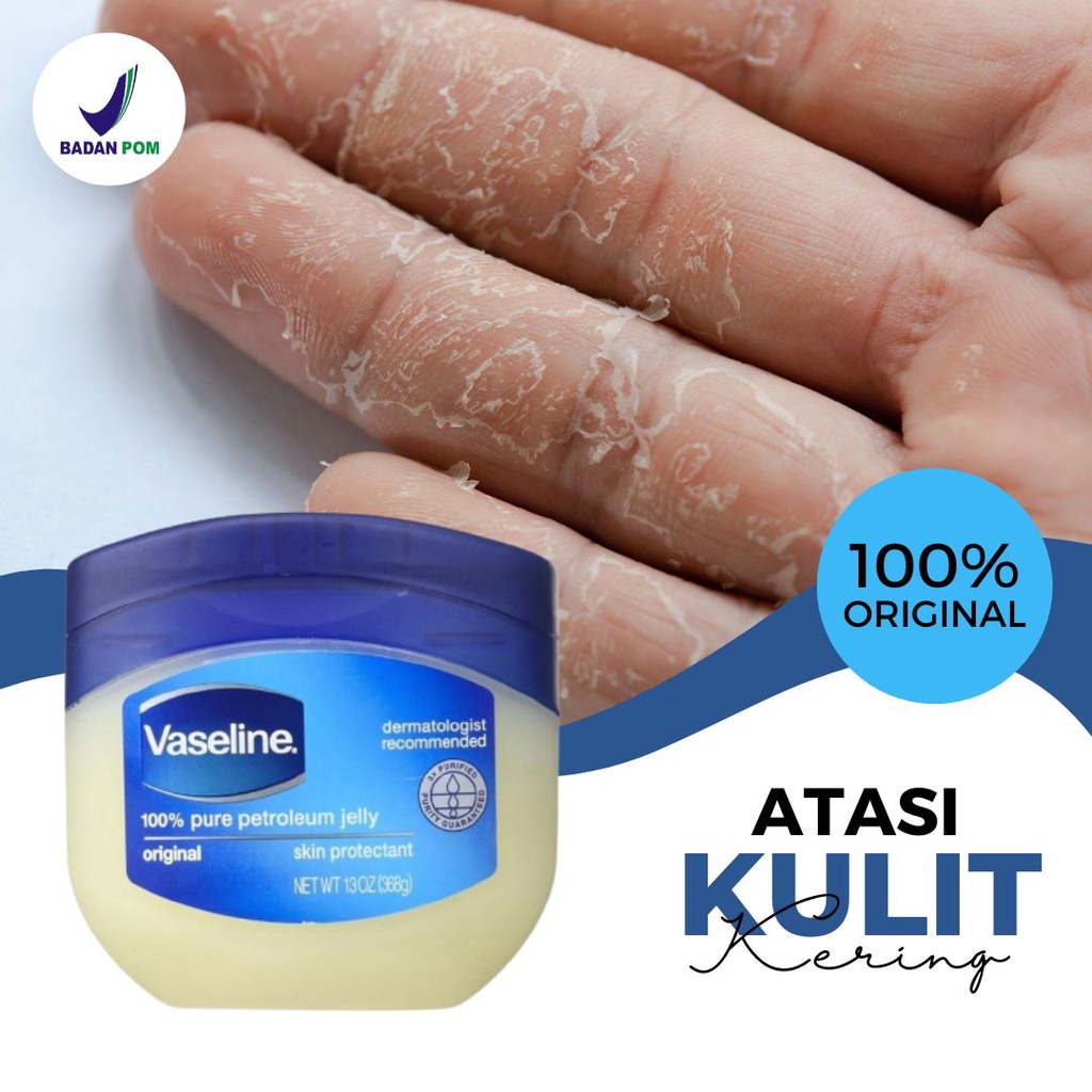 Jual Vaseline Petroleum Jelly Original Pelembab Kulit Sensitif Kering ...