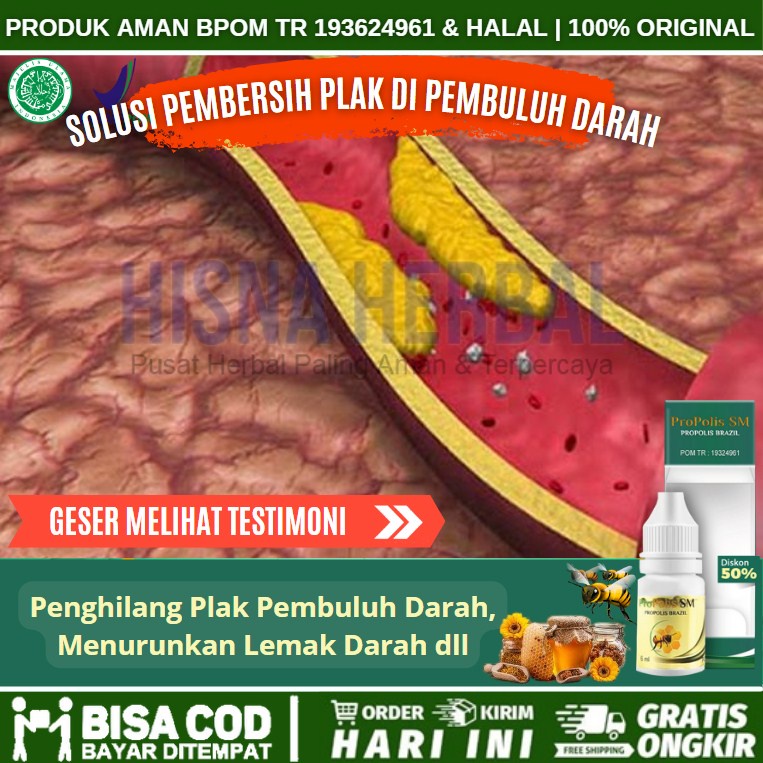 Jual Obat Penghilang Plak Pembuluh Darah, Jamu Penurun Lemak Darah ...
