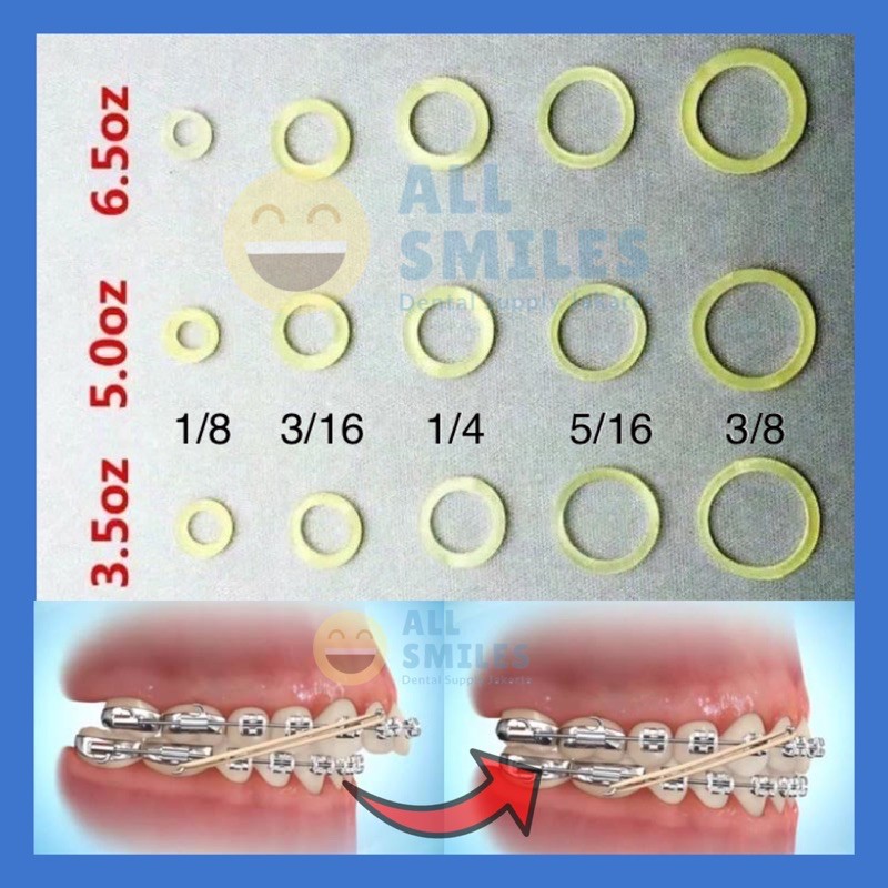 Harga Rubber Band Gigi Terbaru Juli 2024 |BigGo Indonesia