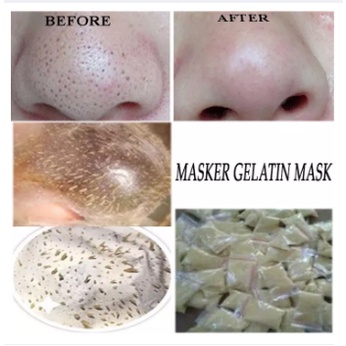 Jual Masker Komedo Gelatin Tulang Sapi Halal | Shopee Indonesia