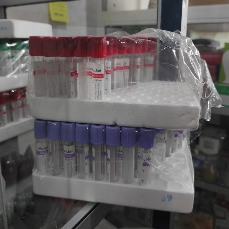 Jual Tabung Sampel Darah / Tabung Vacutainer EDTA dan Plain 3ml ECER ...