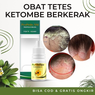 Obat Borok Kepala Di Apotik – Perumperindo.co.id