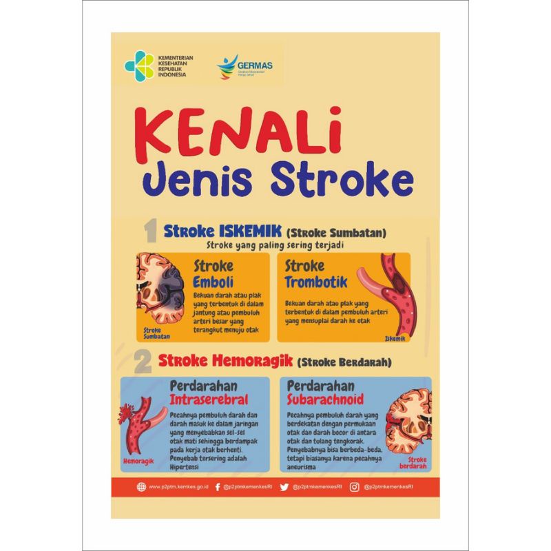 Jual Poster Kenali Jenis Stroke | Shopee Indonesia