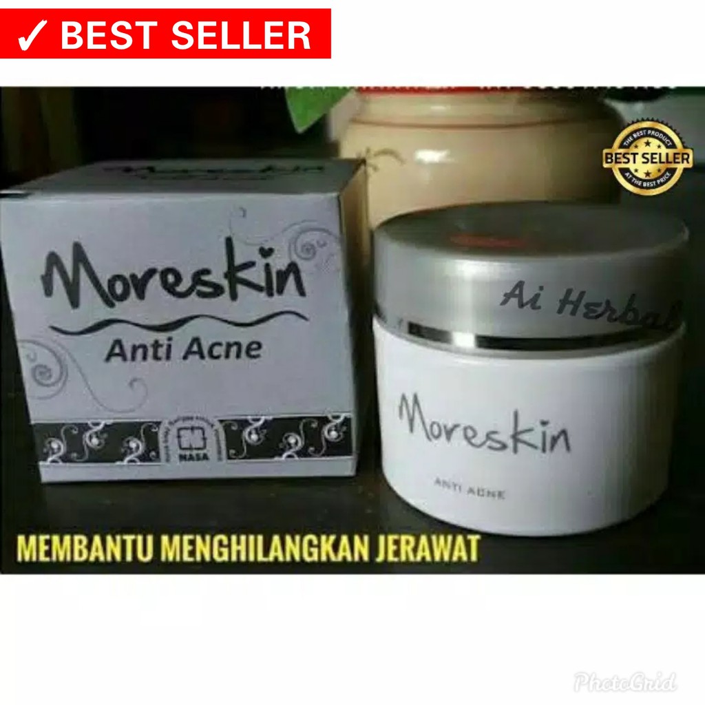 CREAM JERAWAT MORESKIN ANTI ACNE NASA ORIGINAL | Shopee Indonesia
