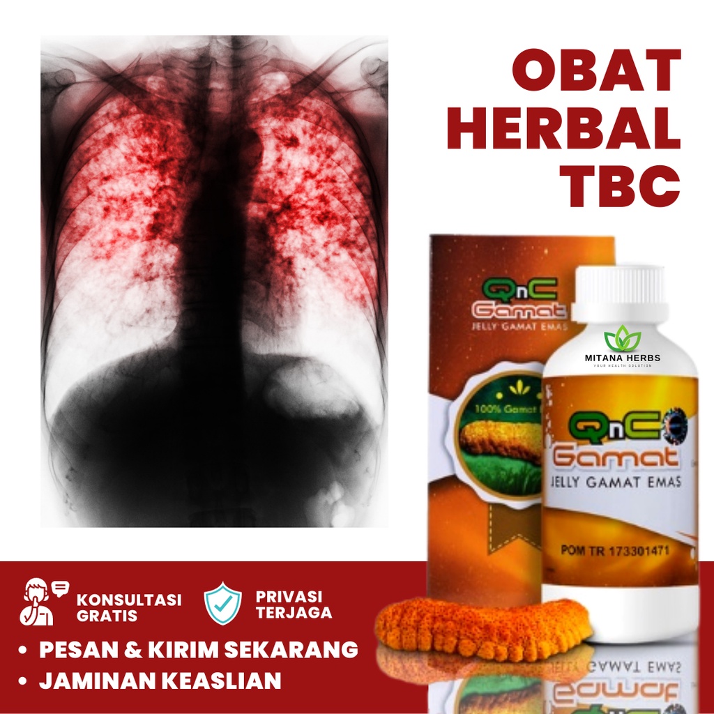 Jual Mitana Herbal, Obat TBC Paru, Obat TBC Anak, Obat TBC Kelenjar, Obat Paru Paru Basah, Obat ...