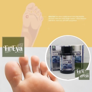 Jual OBAT MATA IKAN, OBAT CLAVUS, OBAT PENEBALAN KULIT, OBAT BENJOLAN ...