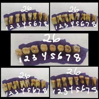 Jual Gigi Asli FKG gigi sulung/ gigi insisive gigi insisif/ gigi ...