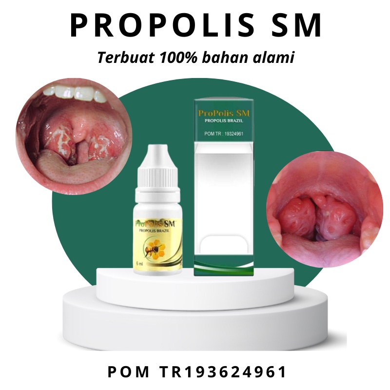 Jual Kaka Herbal - Obat Radang Amandel Untuk Anak & Dewasa, Obat Penghilang Amandel, Amandel ...