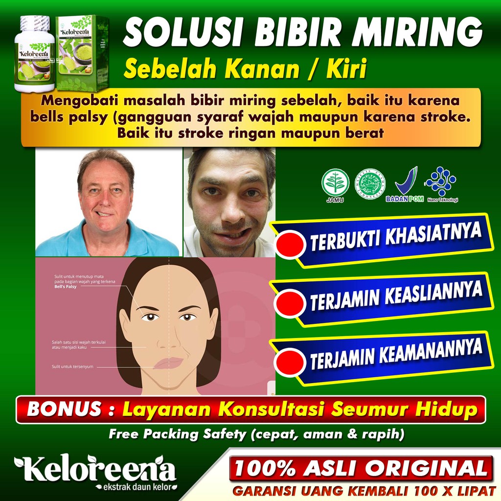 Jual Obat Herbal Bibir Miring, Muka Mencong, Wajah Melorot Sebelah ...