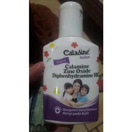 Jual Caladine bedak cair 55ml | Shopee Indonesia