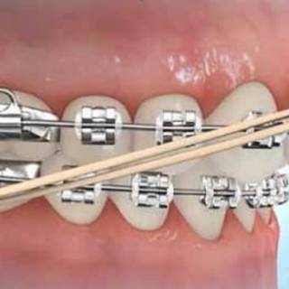 Jual Rubber band elastic band karet elastik behel karet behel karet ...