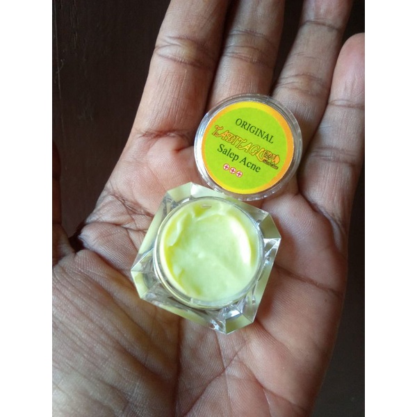 Jual salep Glowing acne | Shopee Indonesia