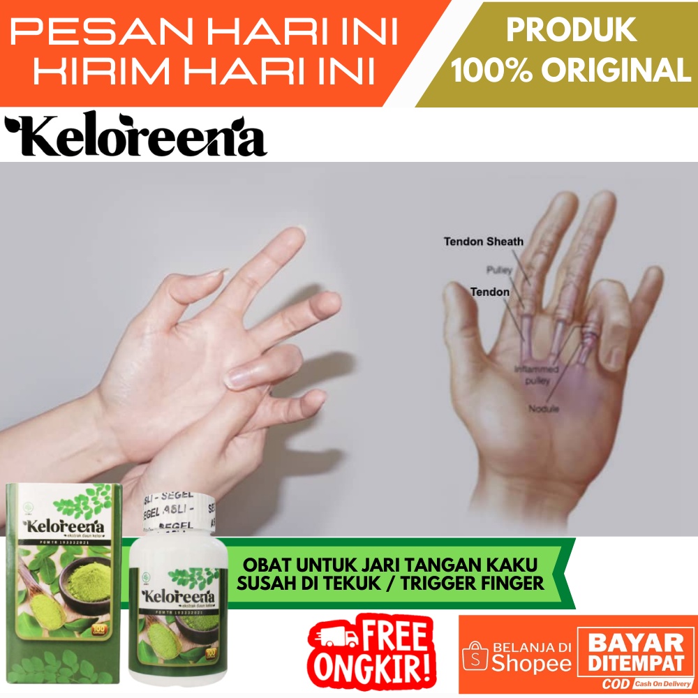 Jual Obat Jari Tangan Kaku Dan Sakit, Jari Susah Ditekuk, Jari Susah ...