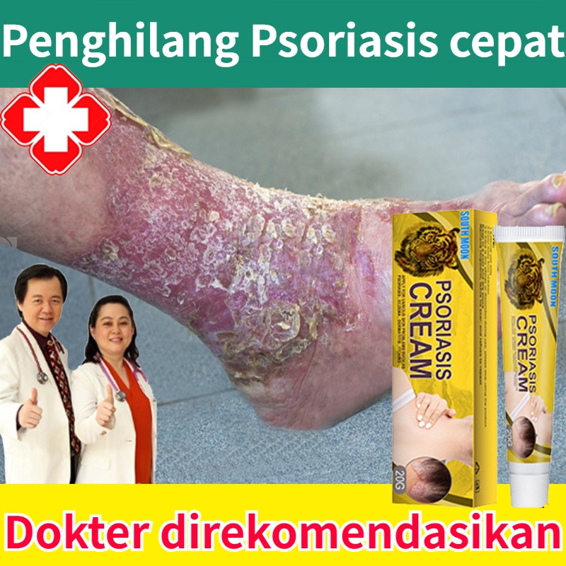 Jual Salep gatal Salep Eksim Salep kulit Krim psoriasis paling ampuh ...