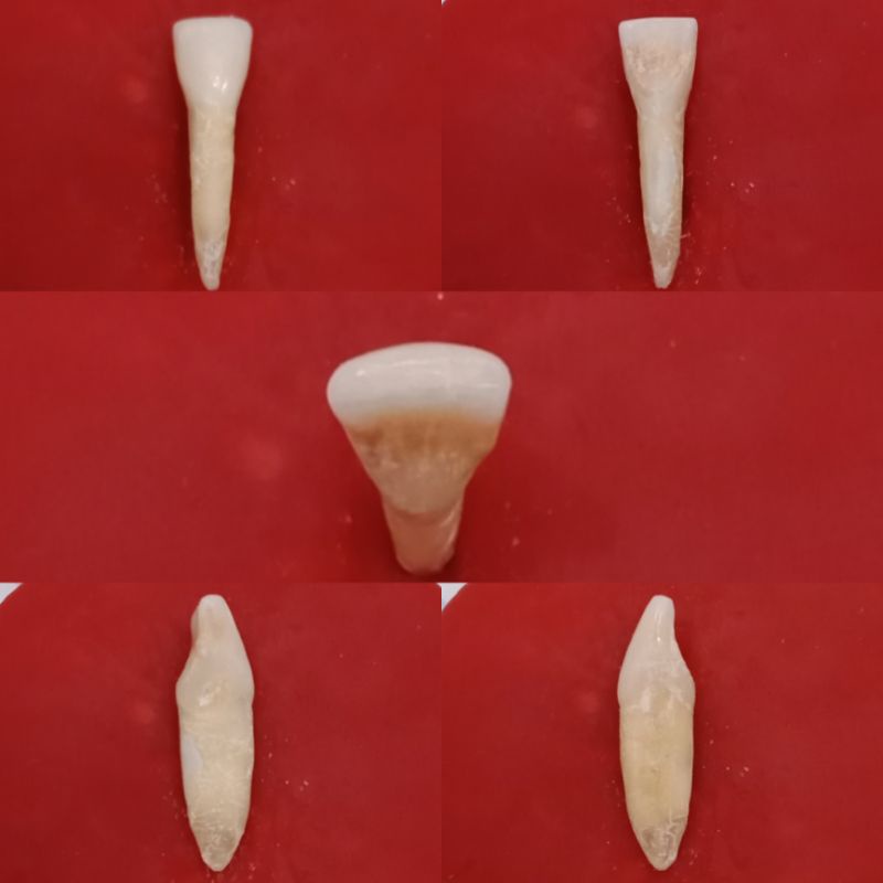 Jual Gigi 42 Gigi Asli Praktikum Gigi Insisif Lateral Kanan Rahang ...