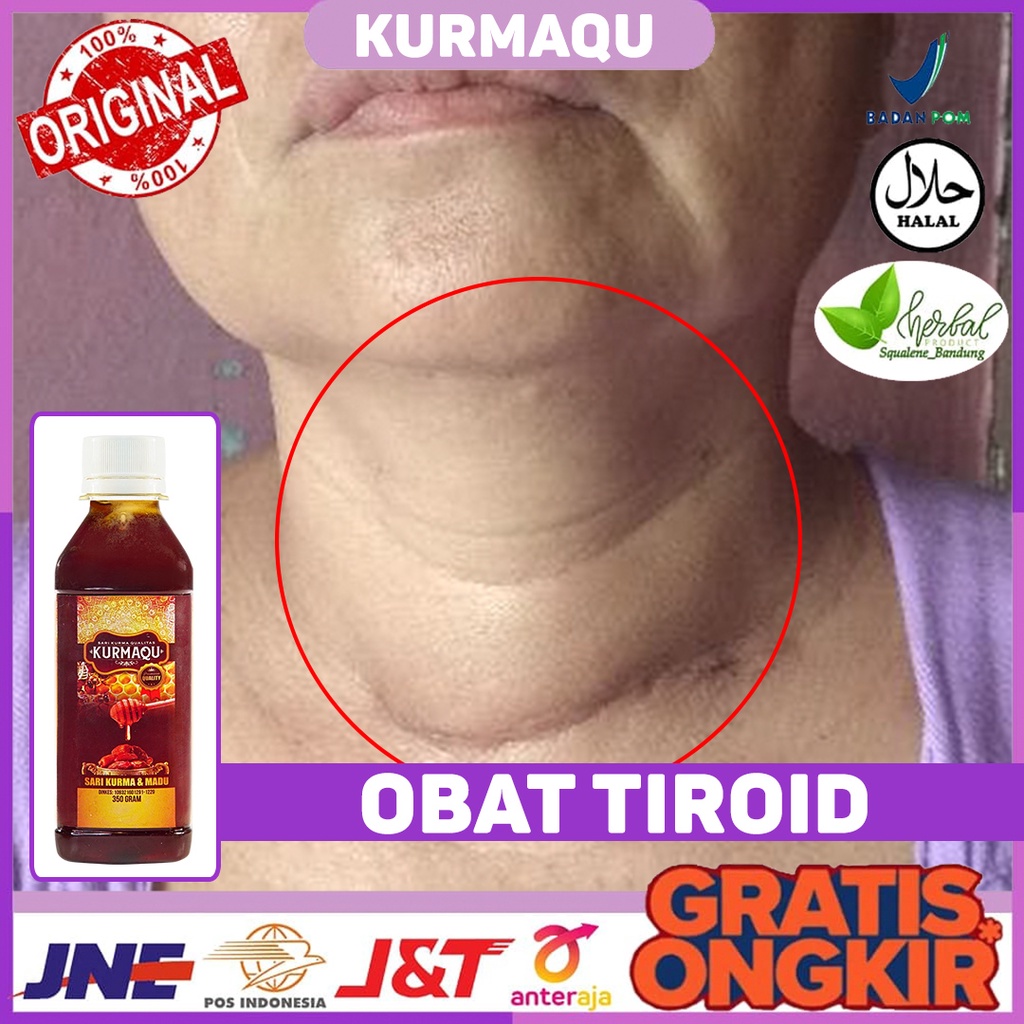 Jual Obat Tiroid - Obat Gangguan Hormon Tiroid (Hipotiroid) - Obat ... Jual Obat Tiroid - Obat Gangguan Hormon Tiroid (Hipotiroid) - Obat ...