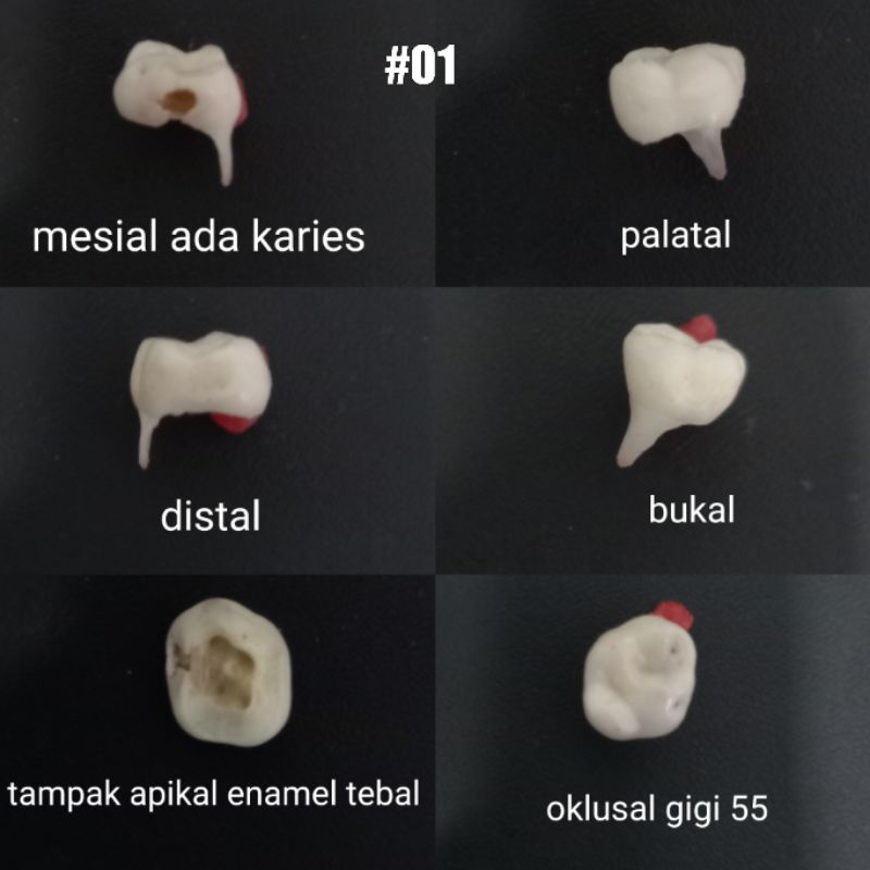 Jual Gigi Molar Anak 55 Praktikum Pedo | Gigi untuk praktikum| Gigi ...