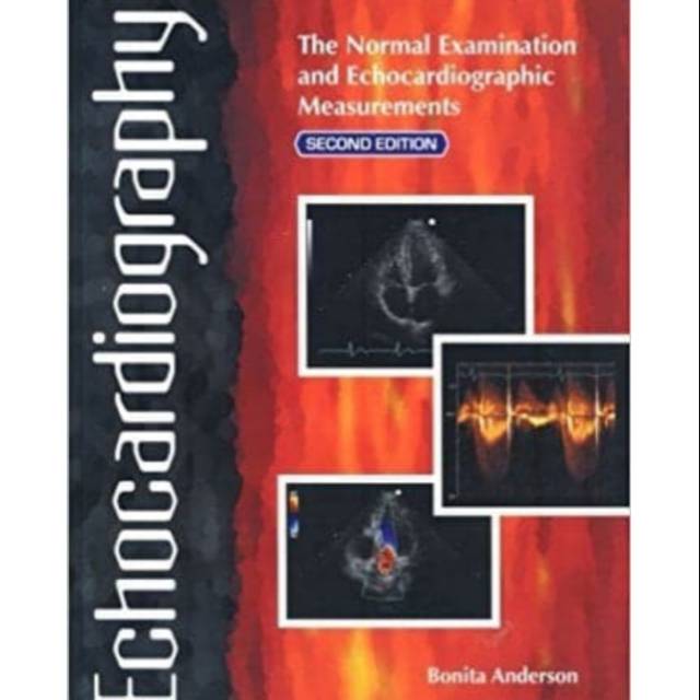 Jual Echocardiography Bonita 2e | Shopee Indonesia