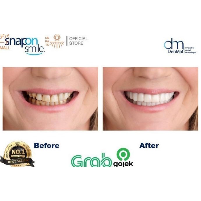 Harga SNAP-ON-SMILE-AUTHENTIC-GIGI-PALSU-SNAPON-SMILE-1-SET-VENEER-GIGI Terbaru April 2023 ...