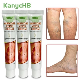 Jual CREAM VARISES VARICOSE OTOT BENGKAK NYERI | Shopee Indonesia