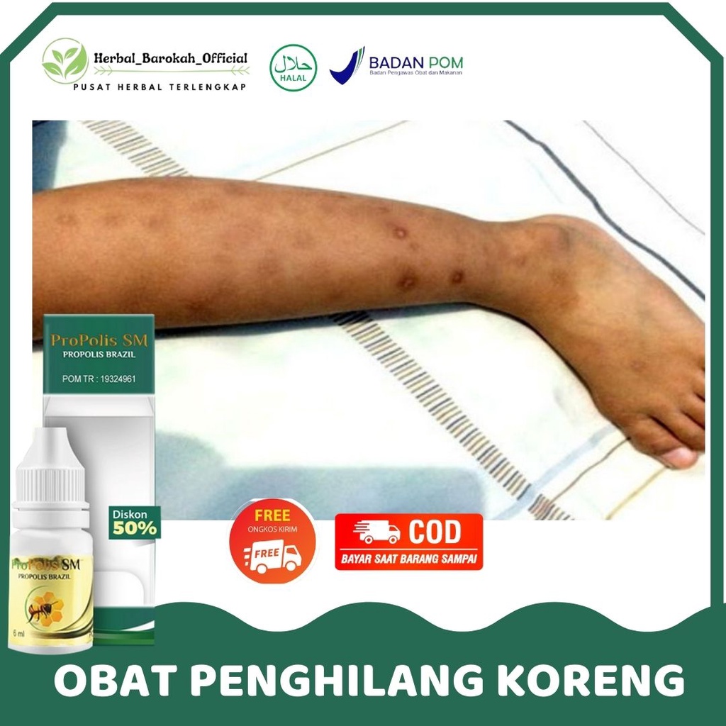 Jual Obat Pembersih Koreng , Koreng Menahun , Bekas Luka Susah Hilang ...