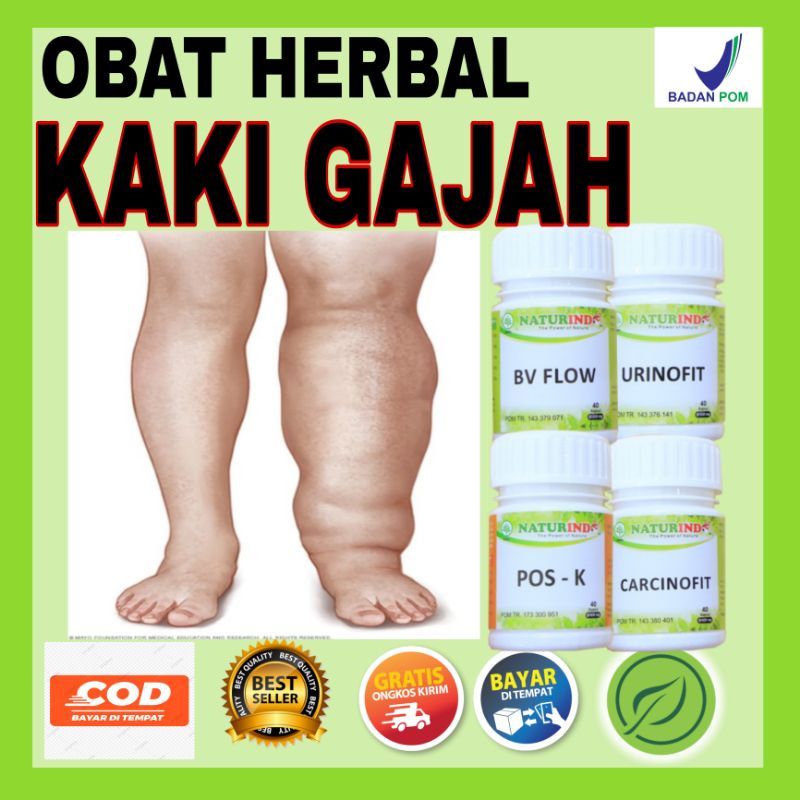 Jual Obat Herbal Kaki Gajah Atau Filariasis Penyakit Infeksi Cacing ...