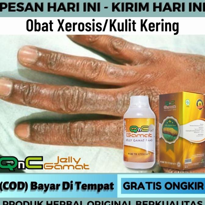 Harga Xerosis Terbaru Desember 2022 |BigGo Indonesia