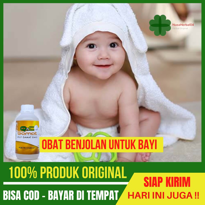 Jual Obat Benjolan Bayi, Benjolan di Kelapa Bayi, Caput Succedaneum ...