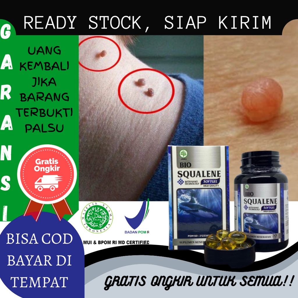 Jual BIO SQUALENE - Obat Penghilang Hilangkan Daging Jadi / Daging ... Jual BIO SQUALENE - Obat Penghilang Hilangkan Daging Jadi / Daging ...