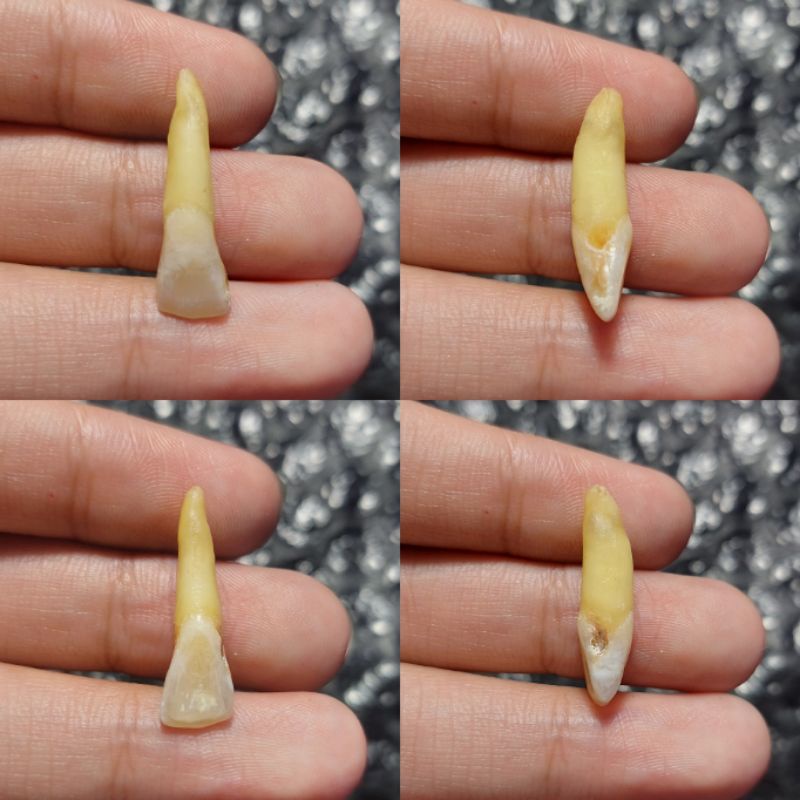 Jual Gigi Insisif 12 | Shopee Indonesia