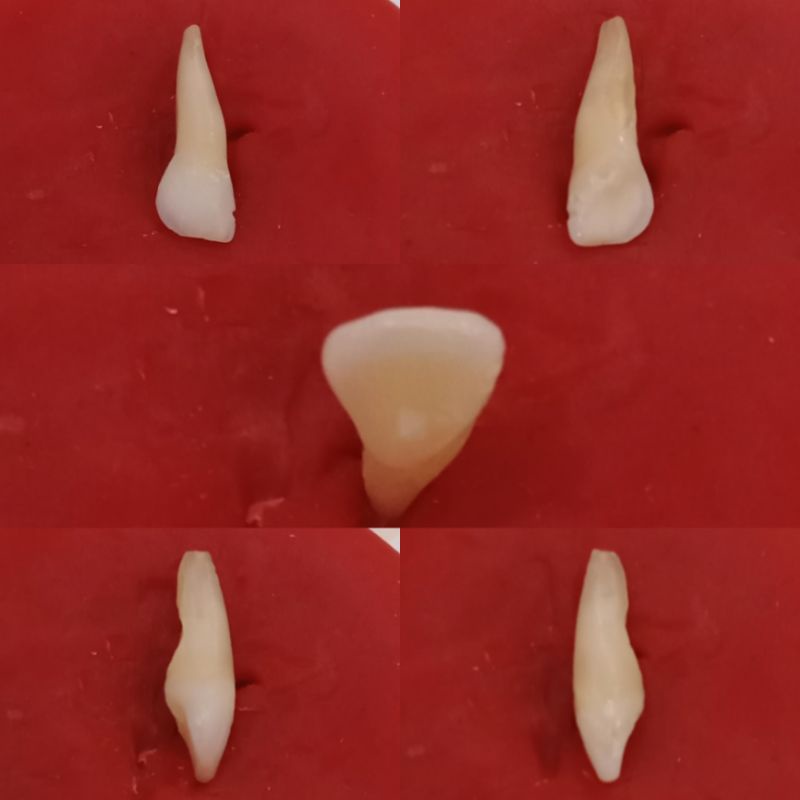 Jual Gigi 52 Pedo Anak Gigi Asli Praktikum Gigi Insisif Lateral Kanan ...