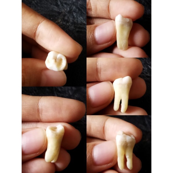 Jual Gigi Molar bawah | Shopee Indonesia