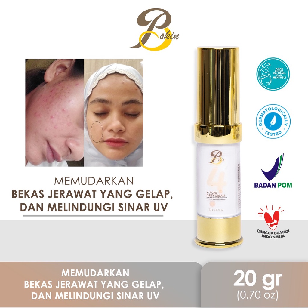 Jual Pb Skin X-Acne Daily Care - Sunscreen Acne | Shopee Indonesia