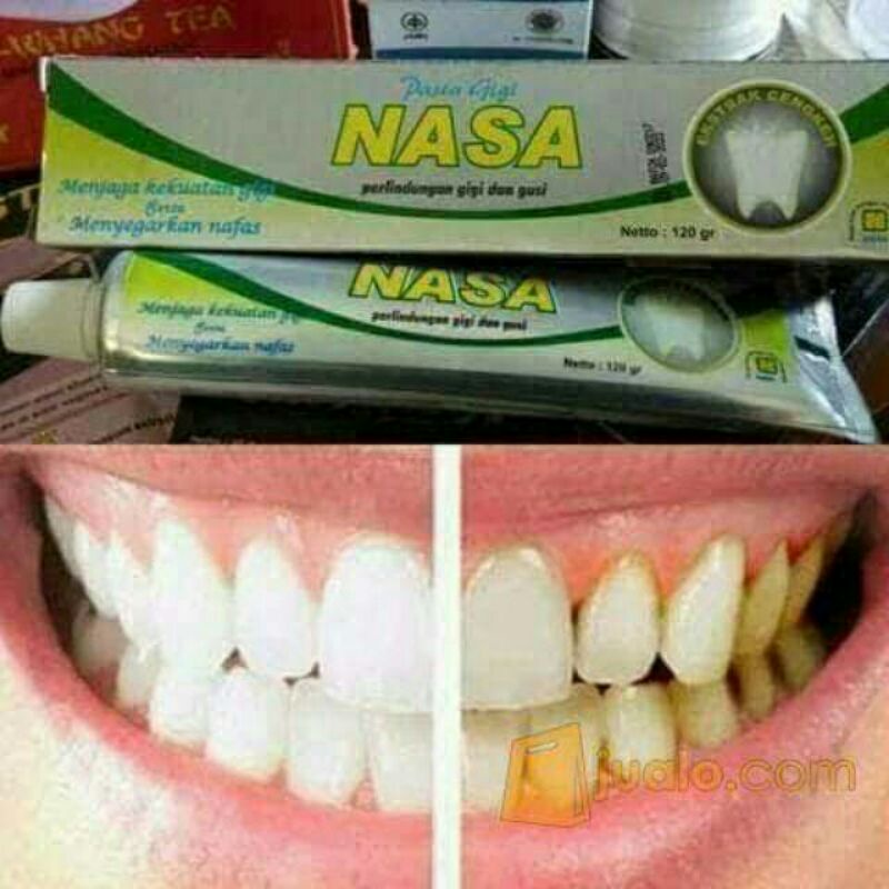 Jual Pasta Gigi Nasa 100%Original | Shopee Indonesia