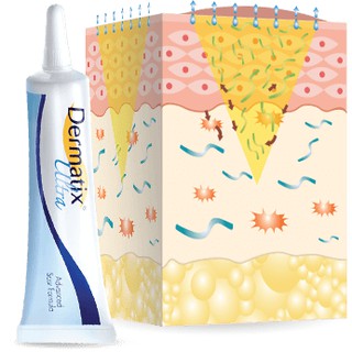 Jual DERMATIX ULTRA | Untuk Menyamarkan Bekas Luka Pada Kulit & Stretch ...