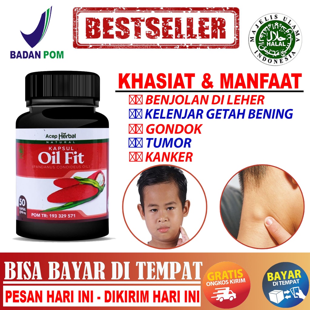 Jual Obat Gondok Anak Dan Dewasa Benjolan Di Leher Kelenjar Getah ...