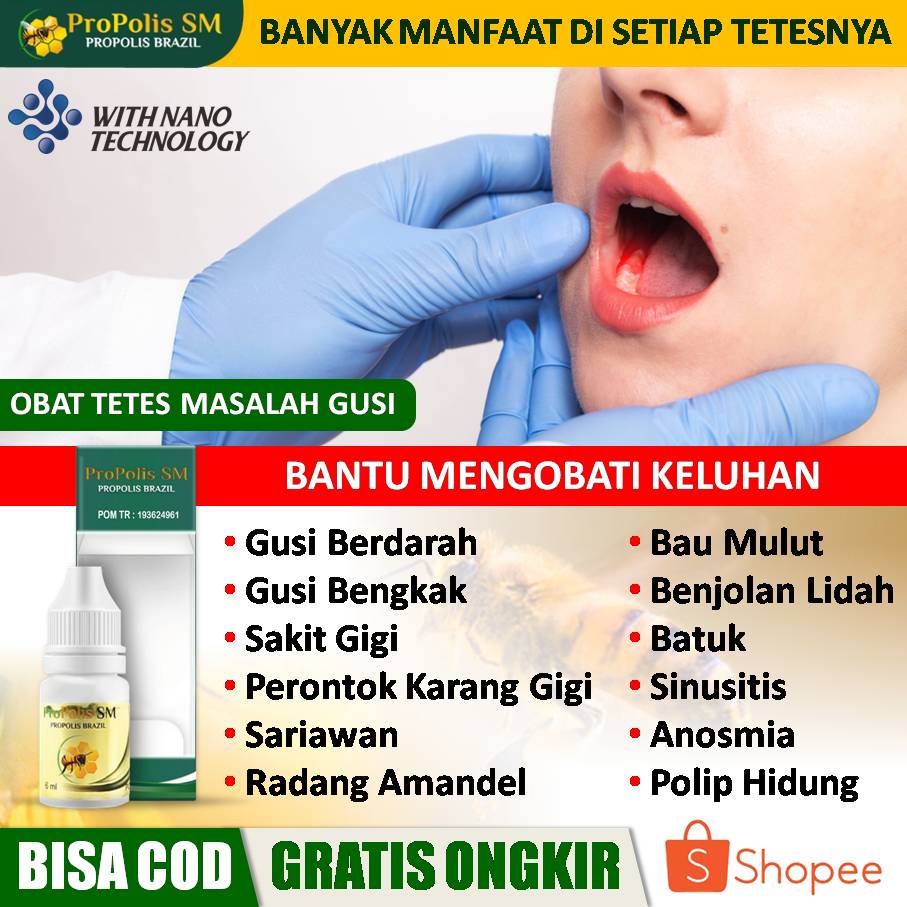 Jual Obat Gusi Berdarah, Bengkak, Radang, Luka, Sariawan, Bau Mulut, Radang Amandel, Sakit Gigi ...