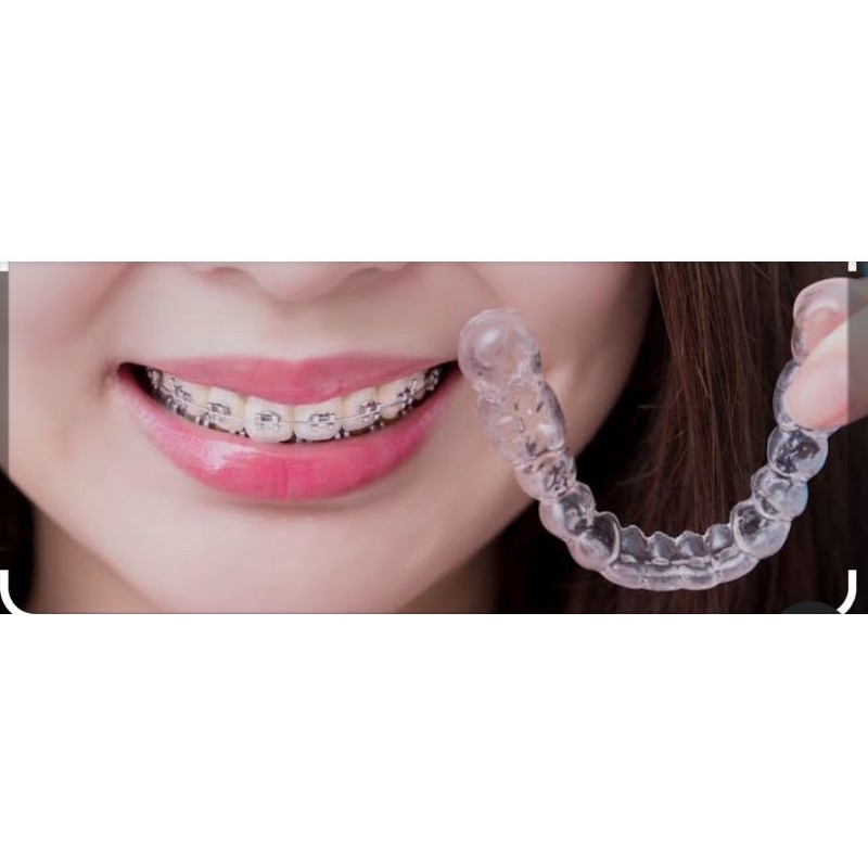 Jual PLASTIK RETAINER PASCA LEPAS BEHEL BRACKET 1PC Indonesia|Shopee ...