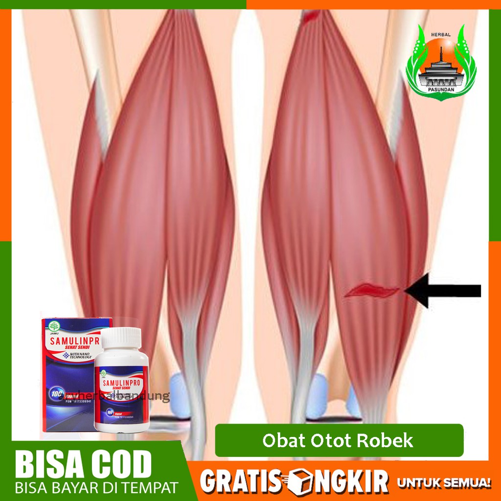 Jual Obat Otot Robek - Nyeri Otot - Otot Luka dan Bengkak Herbal Alami ...