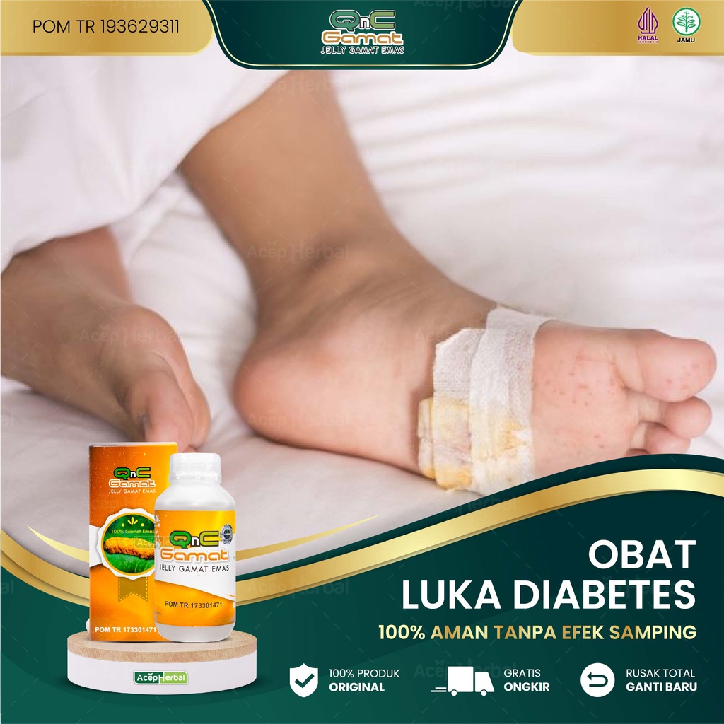 Jual Obat Luka Diabetes Agar Cepat Kering Kulit Melepuh Lepuh Bakar ...