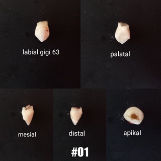 Jual Gigi CANINUS ANAK 63 | Gigi Taring anak rahang atas kiri | Gigi ...