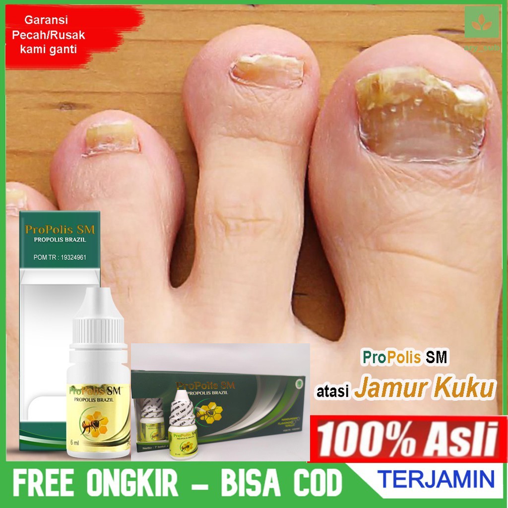 Jual Obat Jamur di Kaki, Obat Infeksi Jamur Kuku Kaki, Obat Jamur Di ... Jual Obat Jamur di Kaki, Obat Infeksi Jamur Kuku Kaki, Obat Jamur Di ...