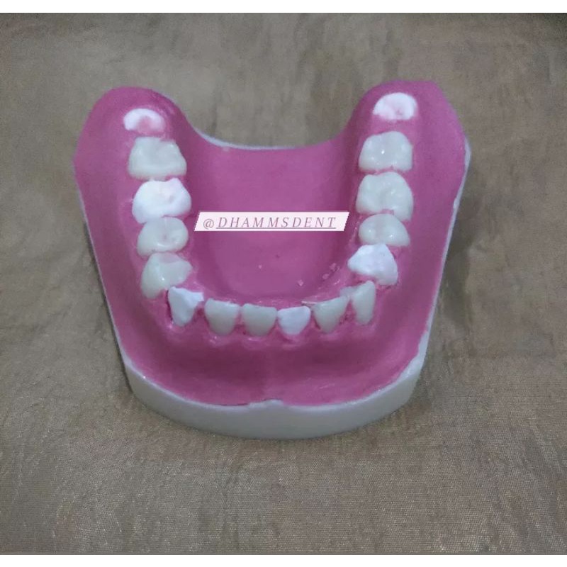 Jual Model Phantom Odontektomi dan Ekstraksi | Shopee Indonesia