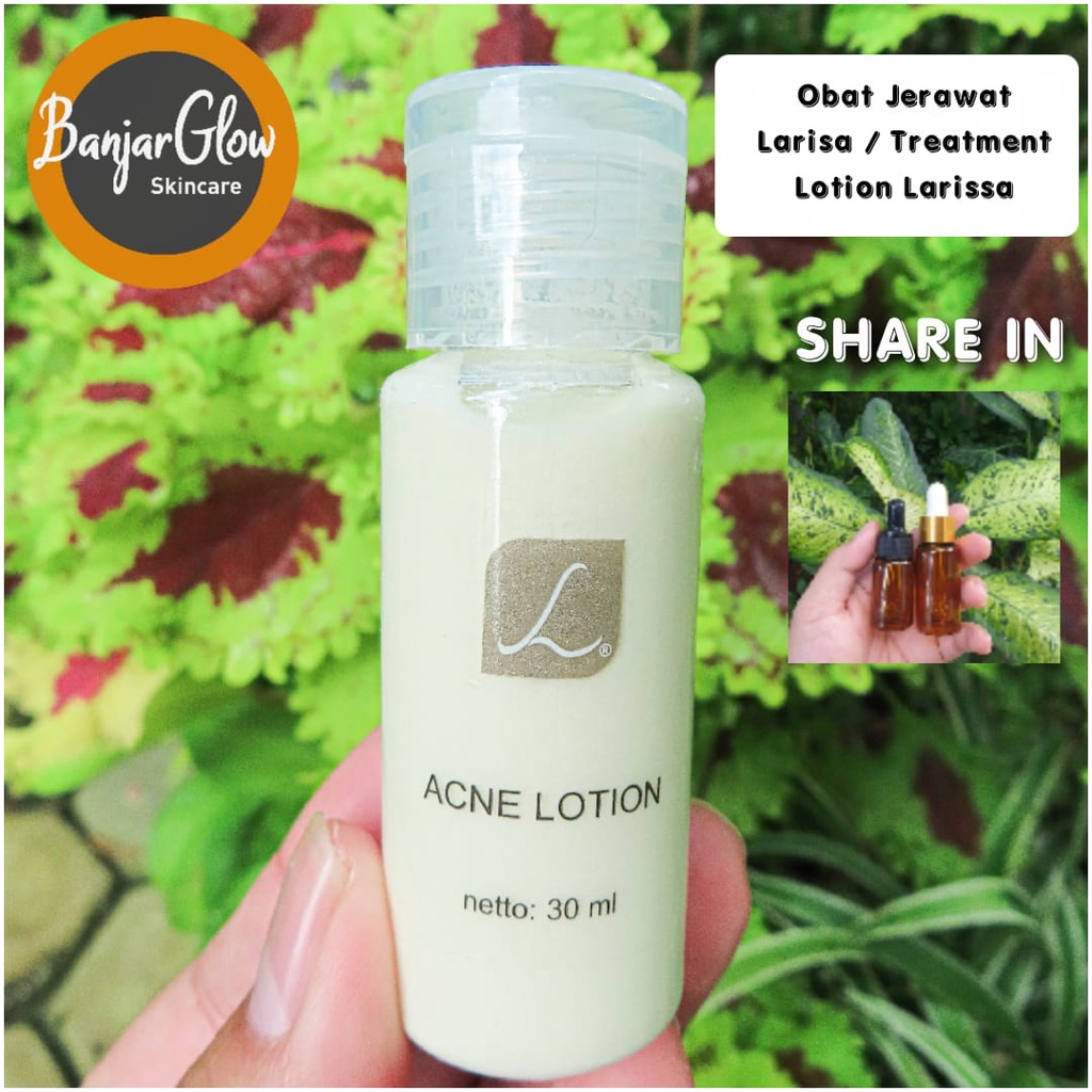 Jual Obat Jerawat Larisa / Treatment Acne Lotion Larissa SHARE DAN FULL ...