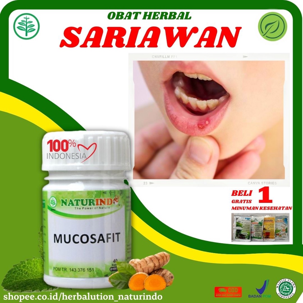 Jual Obat Sariawan Mulut Sariawan Anak Bayi Ampuh Sariawan Di Bibir ...