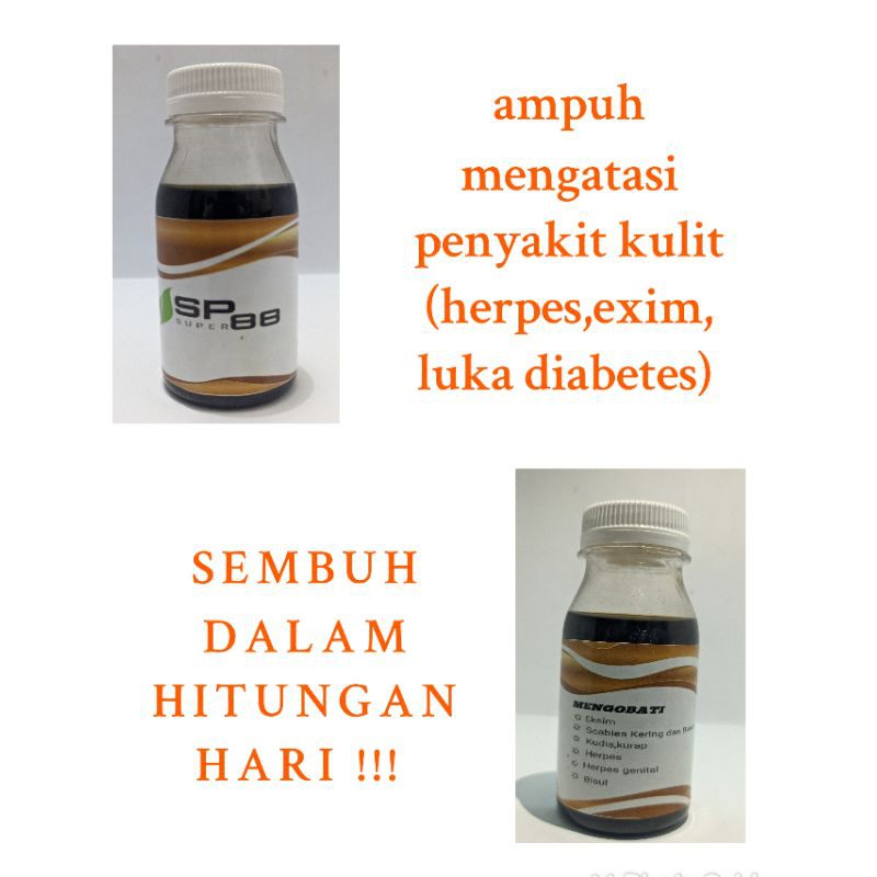 Jual OBAT EXSIM, HERPES PALING AMPUH!! Indonesia|Shopee Indonesia