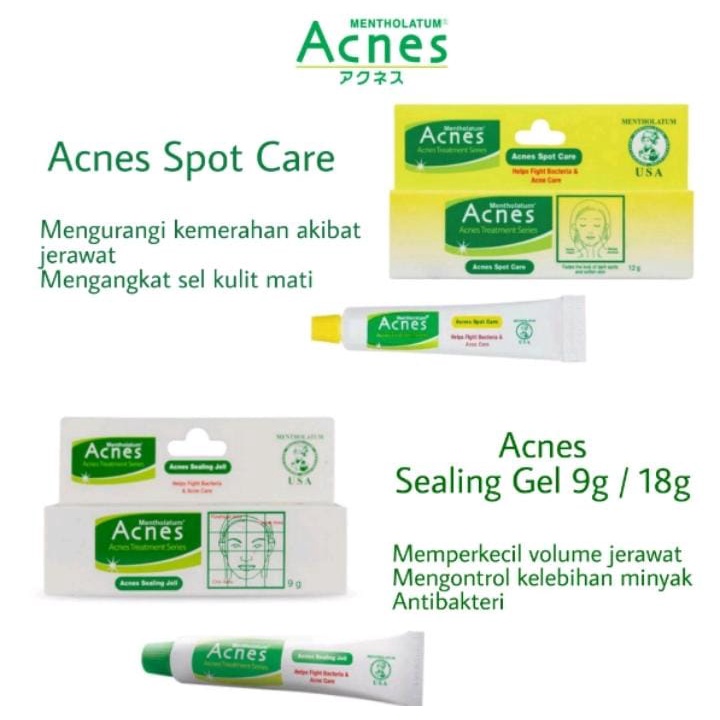 Jual Acnes Treatment Series Spot Care / Sealing Jell 12g/9g Original ...