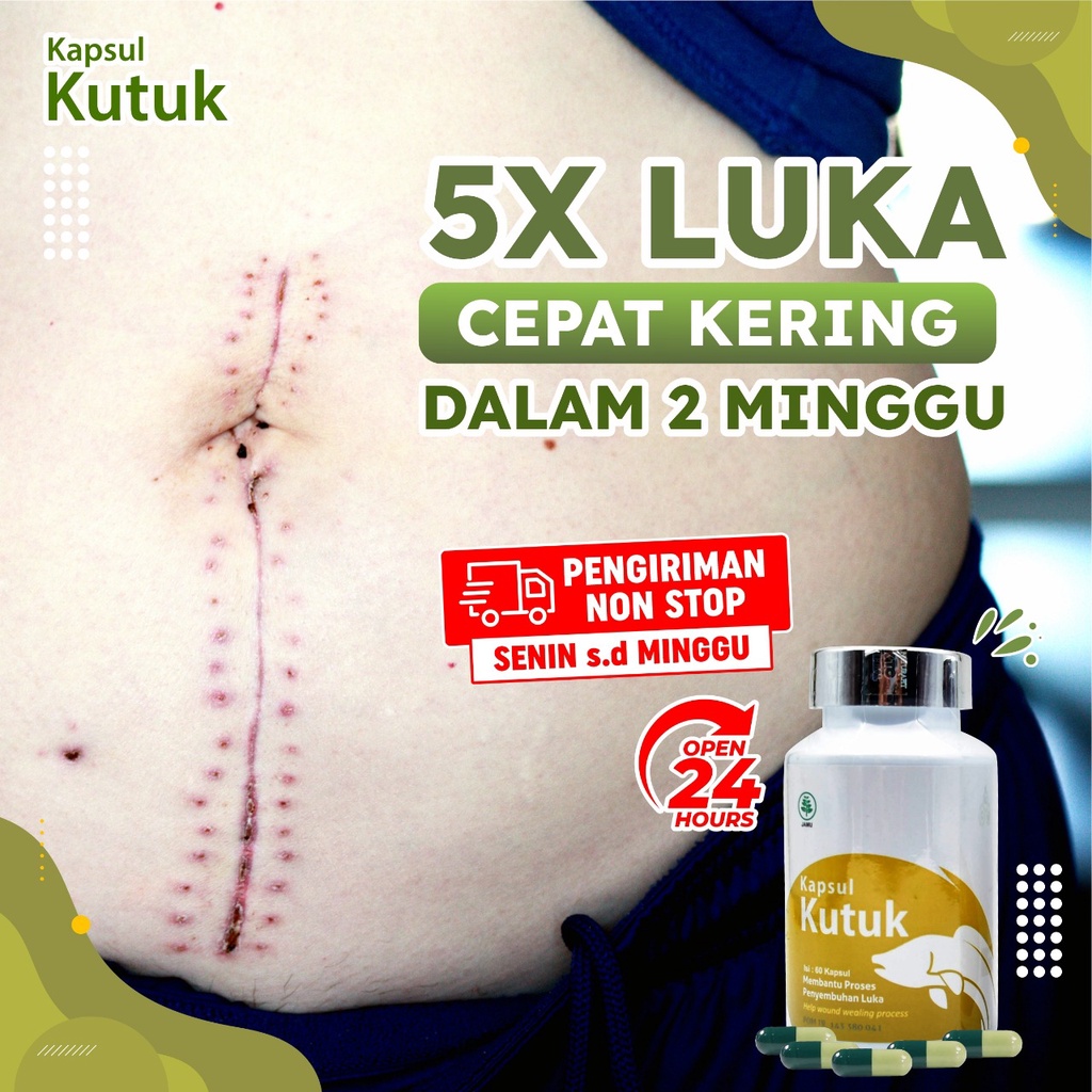 Jual Kapsul Kutuk - Kapsul Pasca Operasi ASLI 100% - Ekstrak Albumin ... Jual Kapsul Kutuk - Kapsul Pasca Operasi ASLI 100% - Ekstrak Albumin ...