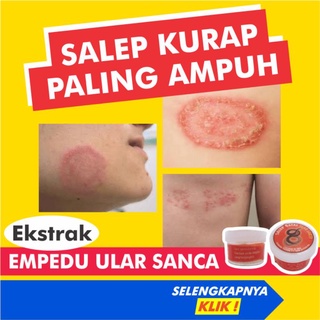 Jual Salep Obat Kurap Kudis Paling Ampuh Gatal Kulit Gatel Kadas Eksim ...