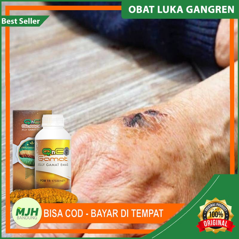 Jual Obat Penghilang Bekas Luka Diabetes (Gangren) - Luka Diabetes ...